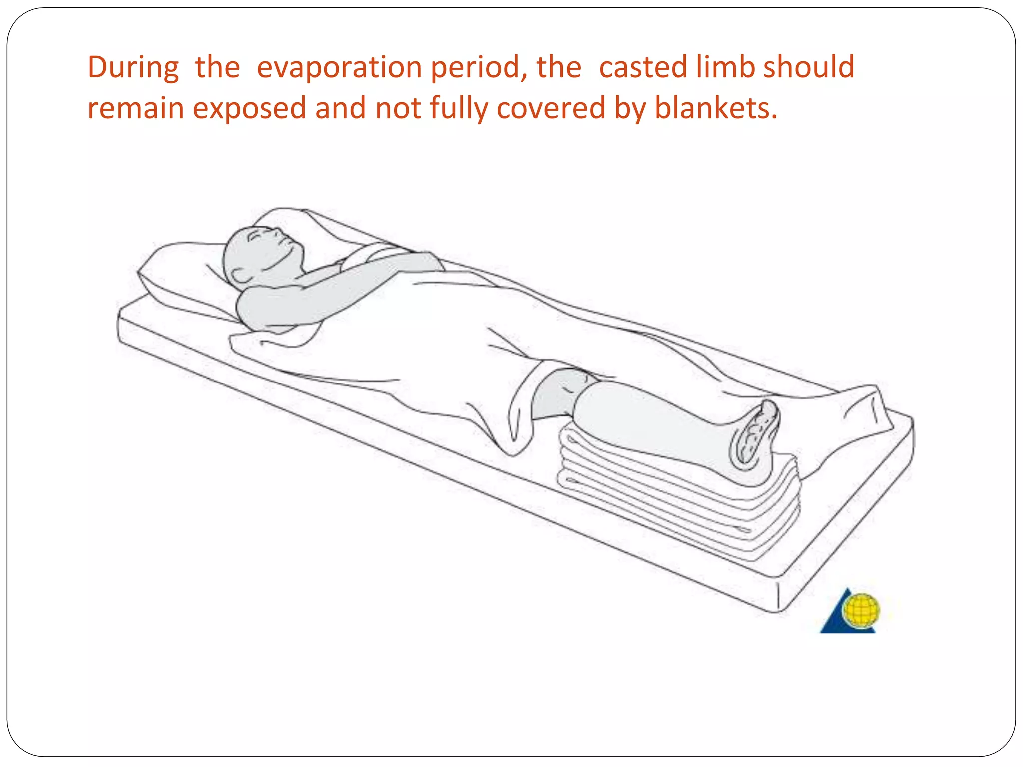 POP PLASTER AND CAST TECHNIQUES | PPTX