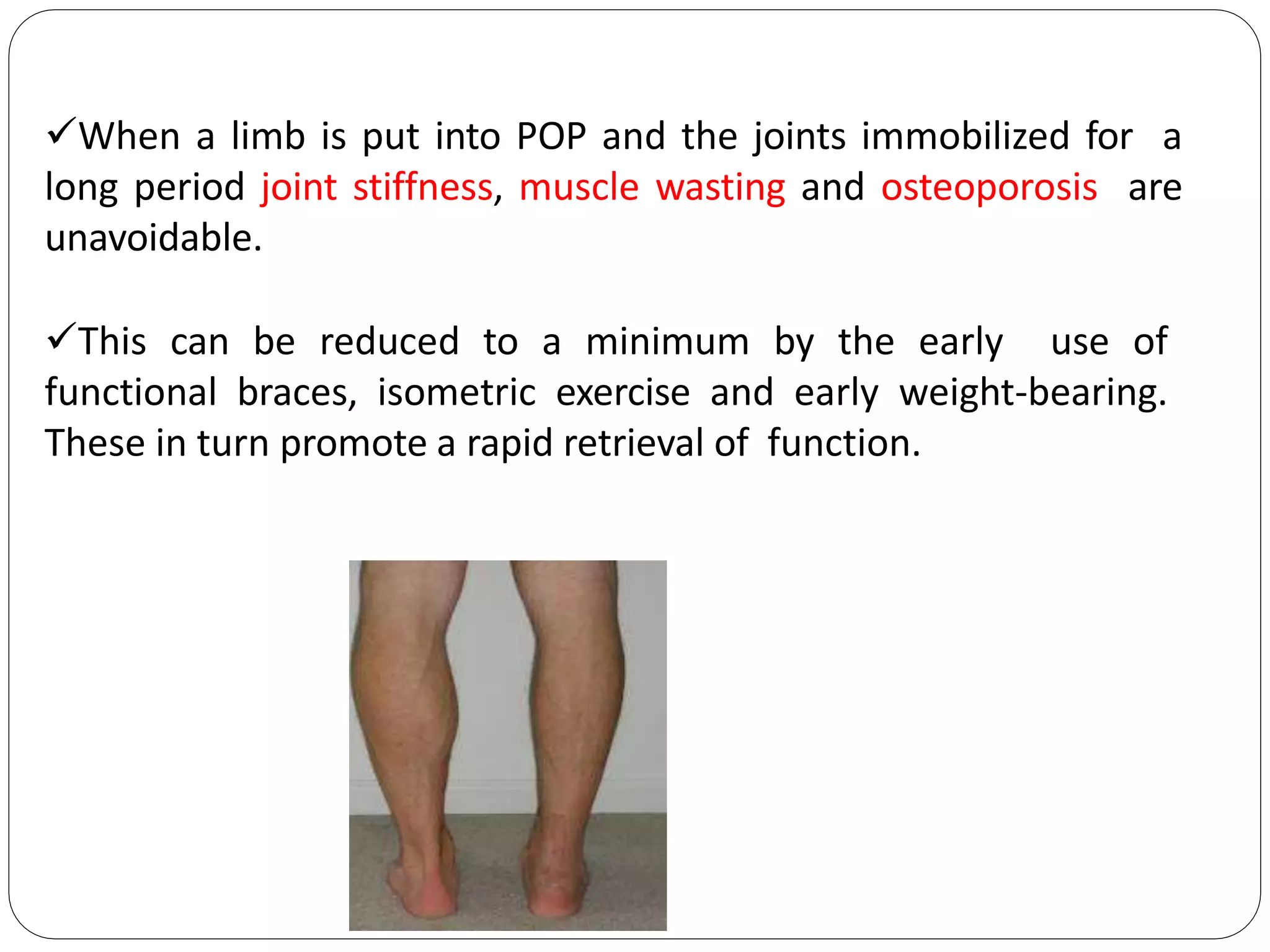 POP PLASTER AND CAST TECHNIQUES | PPTX