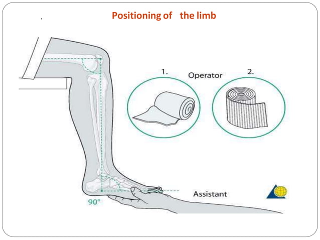 POP PLASTER AND CAST TECHNIQUES | PPTX | First Aid | Injuries