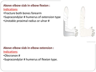 POP PLASTER AND CAST TECHNIQUES | PPTX