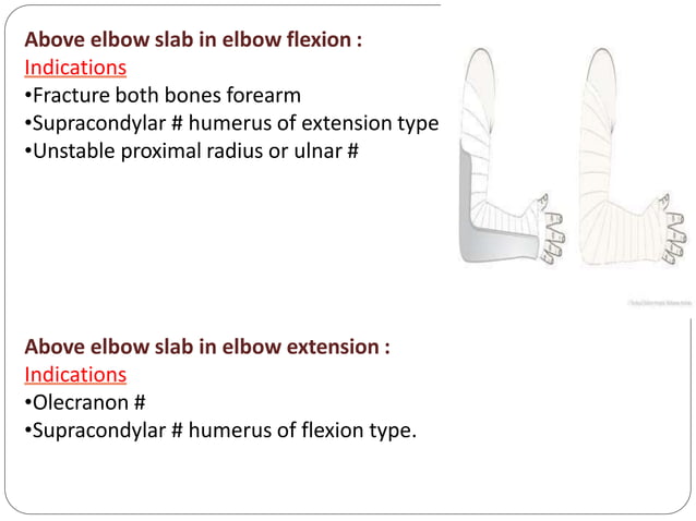 POP PLASTER AND CAST TECHNIQUES | PPTX | First Aid | Injuries
