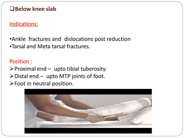 POP PLASTER AND CAST TECHNIQUES | PPTX | First Aid | Injuries