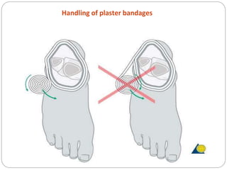 POP PLASTER AND CAST TECHNIQUES | PPTX