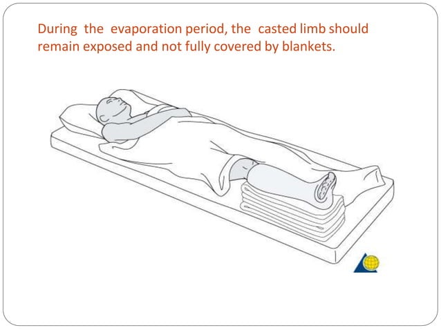 POP PLASTER AND CAST TECHNIQUES | PPTX | First Aid | Injuries