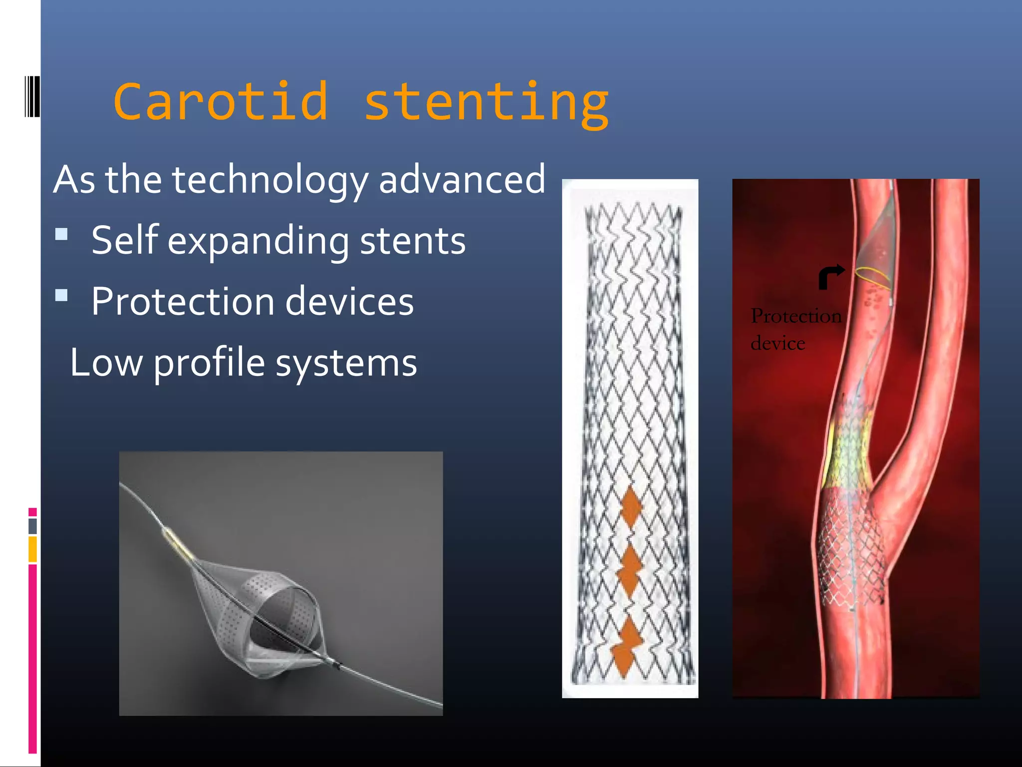 Carotid Artery Stenting | PPT | Heart and Cardiovascular Diseases ...