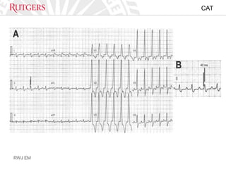 cat--vtach-cardiovert.pptx