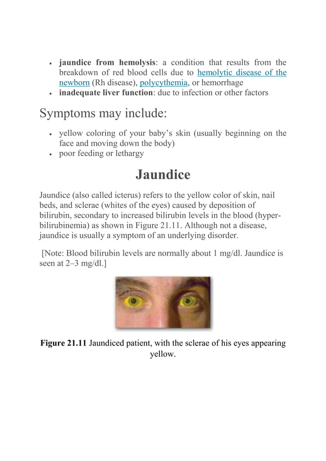 Catabolism of Heme and jaundice by BNP.pdf