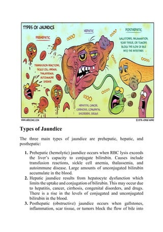 Catabolism of Heme and jaundice by BNP.pdf