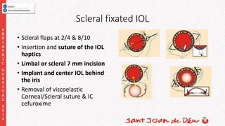 IOL implantation in the absence of capsular bag | PPTX