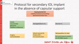 IOL implantation in the absence of capsular bag | PPTX | Eye and Vision ...