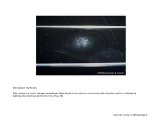 CATALASE-TEST.pptx