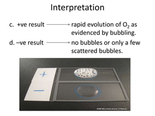 Staphylococcus Aureus Catalase Test