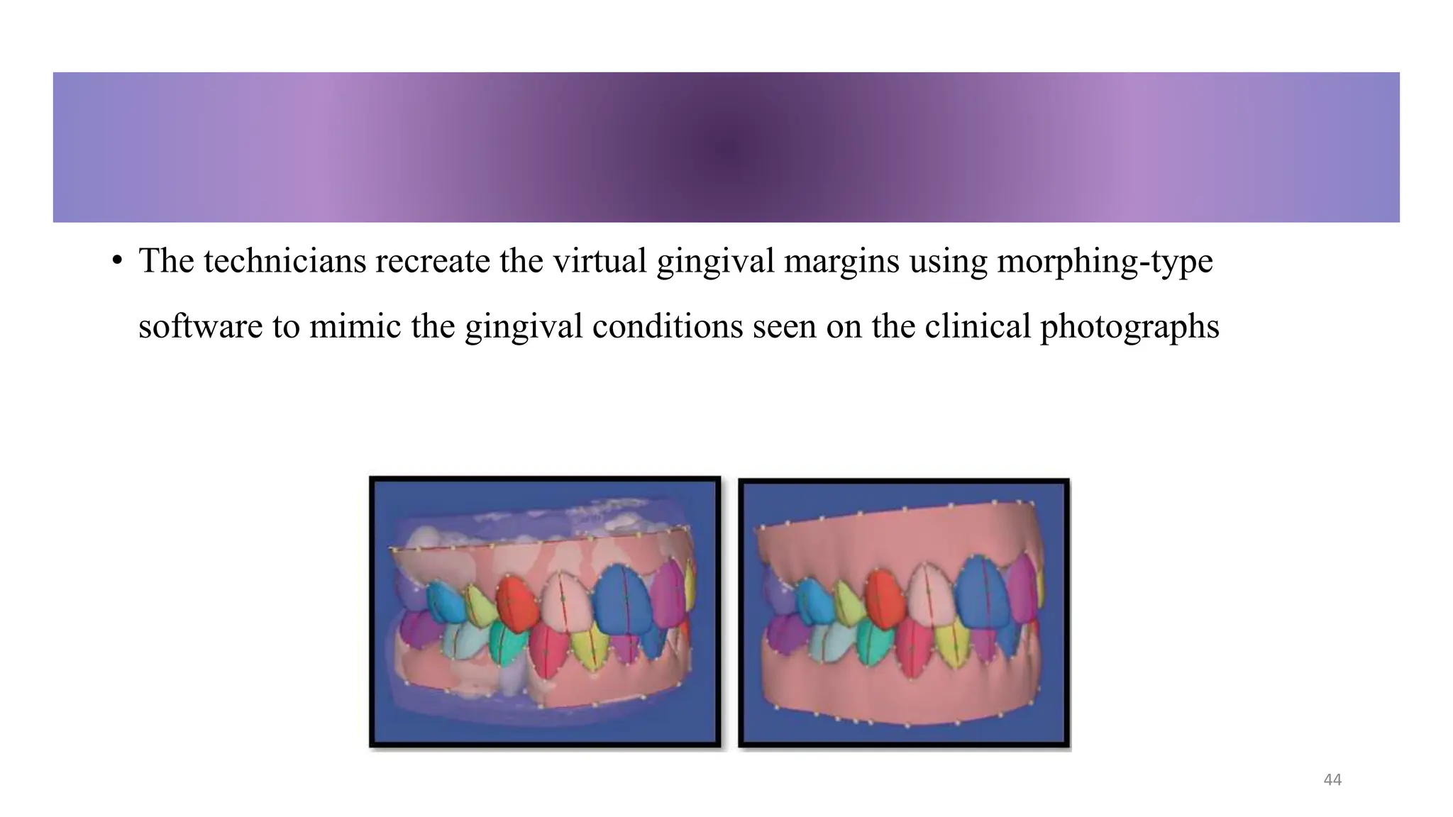 Clear Aligner In Orthodontics A Complete Guid Pptx