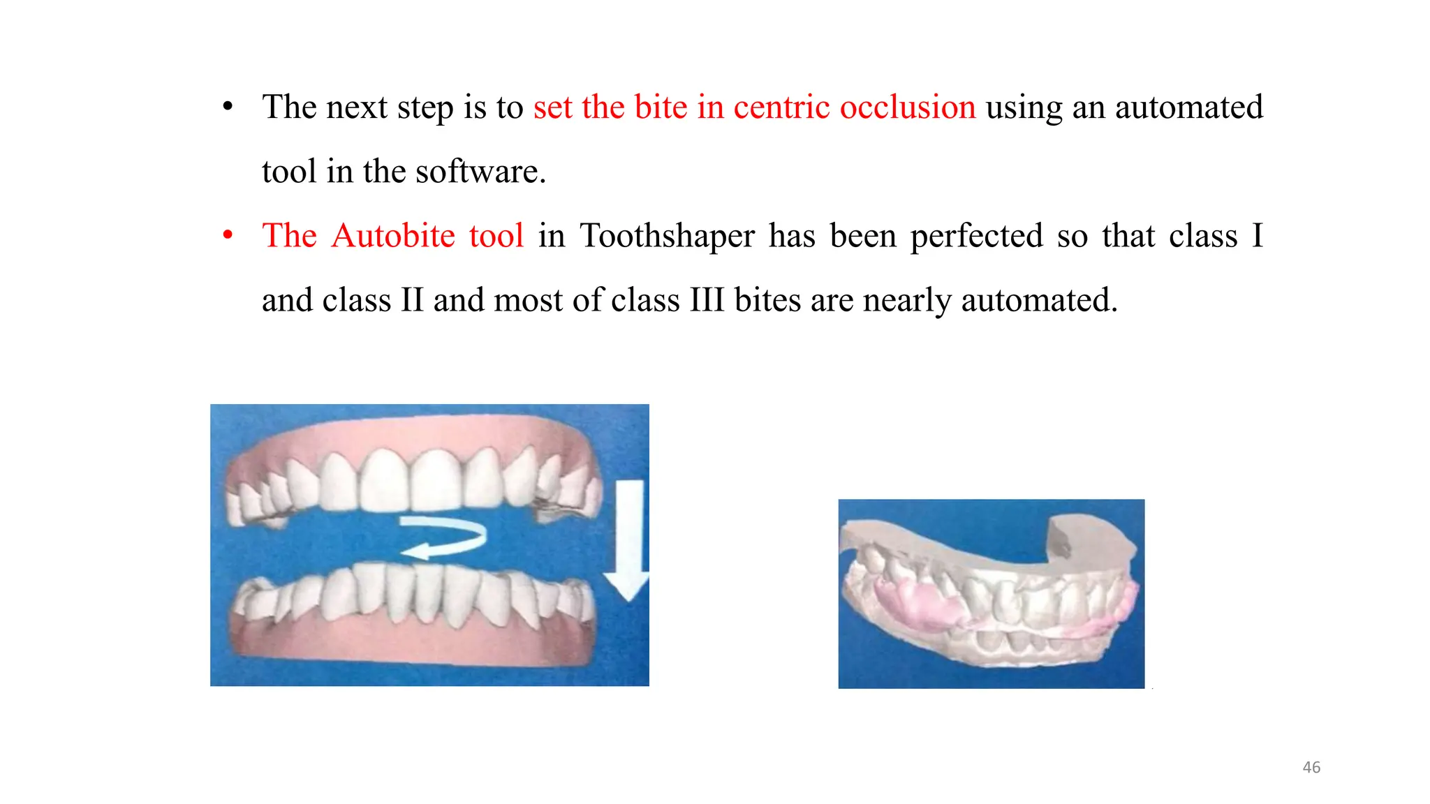 Clear Aligner In Orthodontics A Complete Guid Pptx