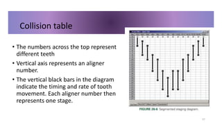 clear aligner in orthodontics a complete guid.pptx