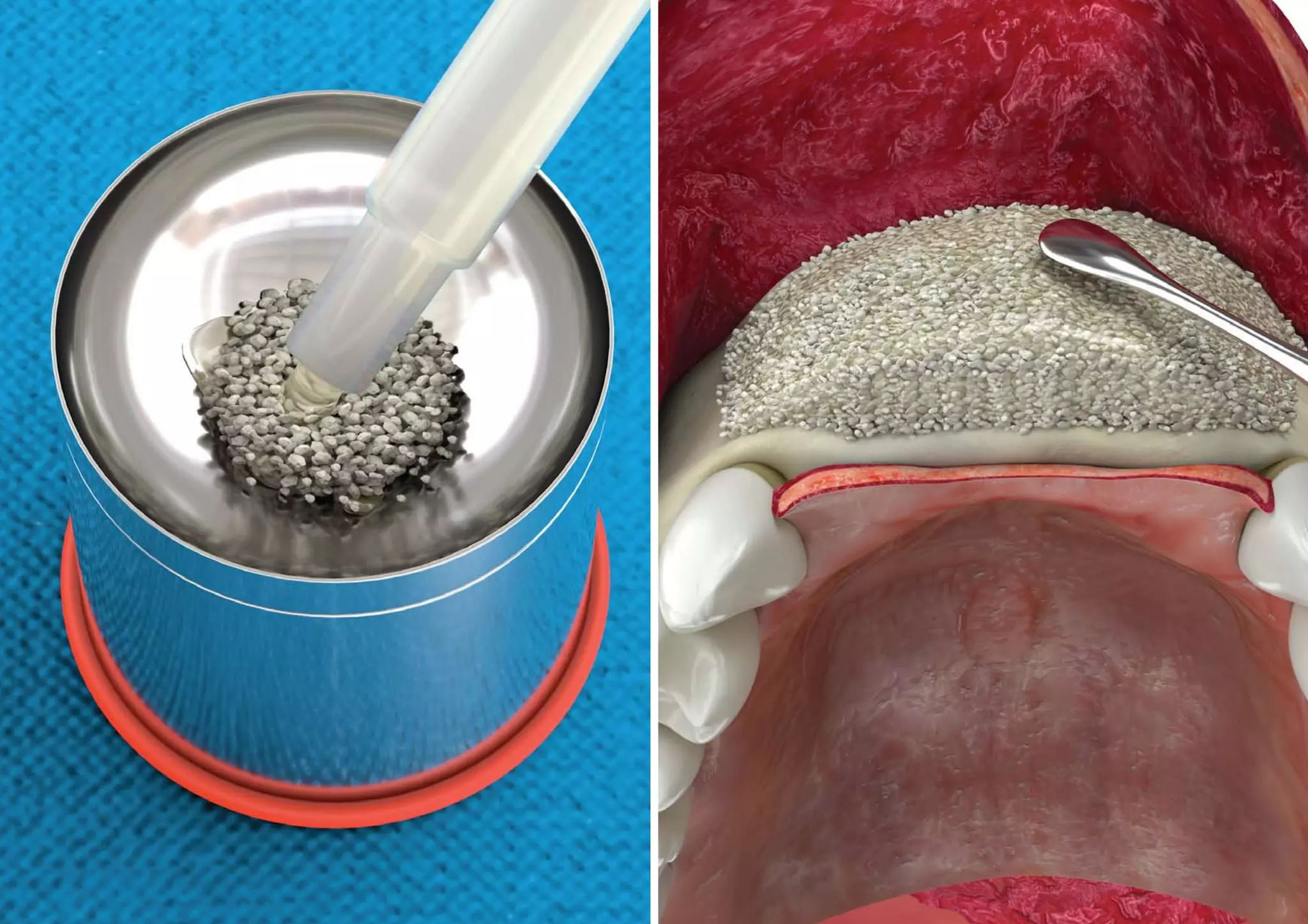 Catalog Osteobiol 2020 EN | PDF