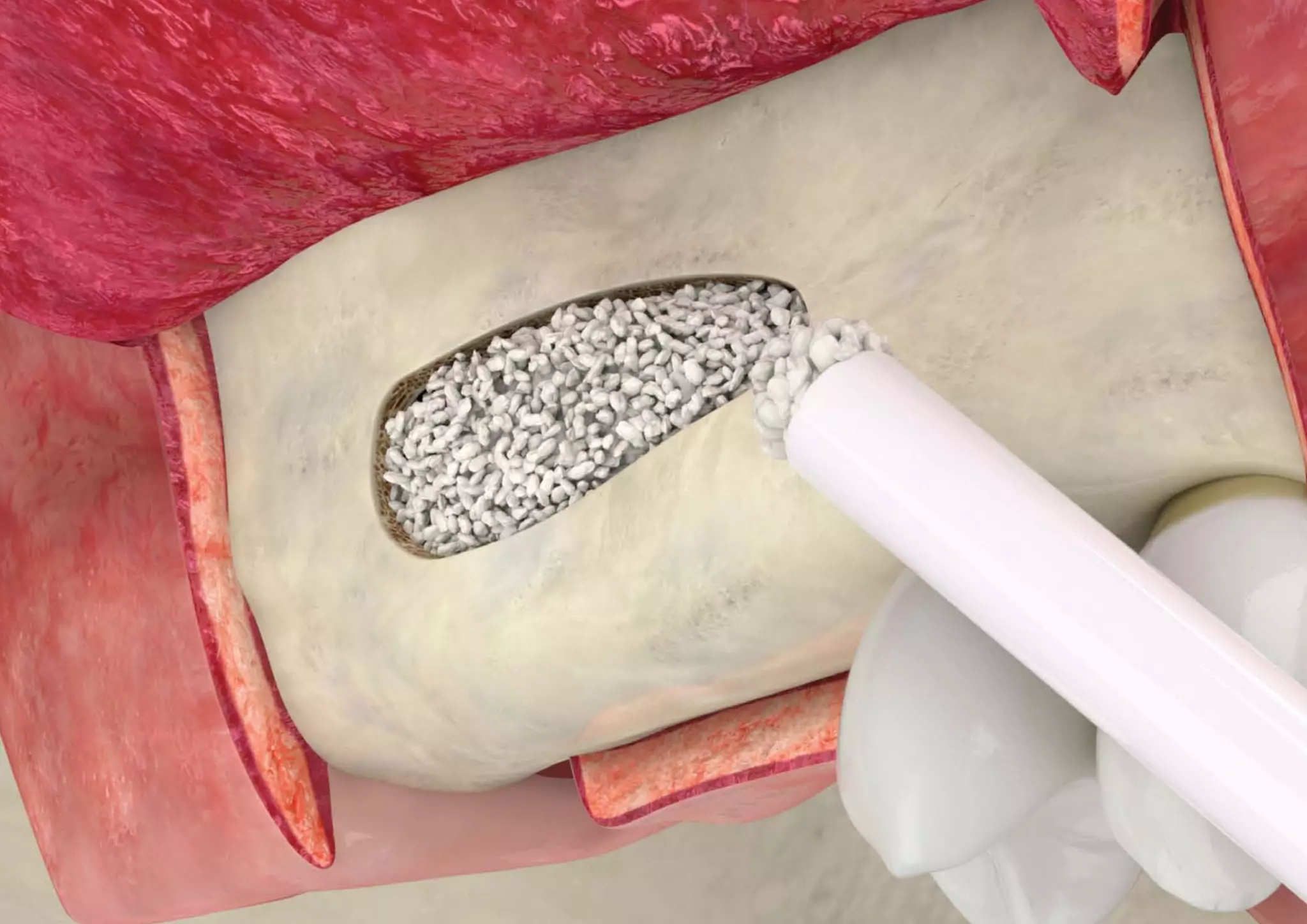 Catalog Osteobiol 2020 EN | PDF