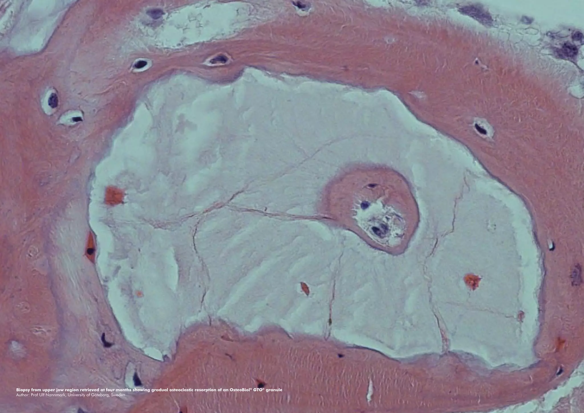 Catalog Osteobiol 2020 EN | PDF