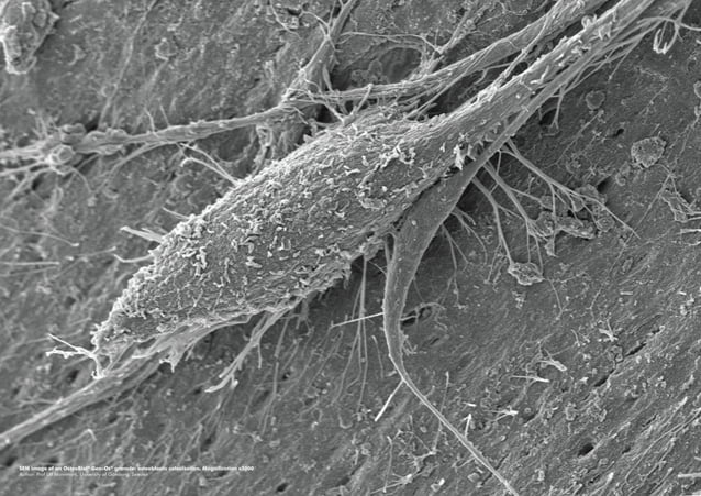 Catalog Osteobiol 2020 EN | PDF | Bone and Joint Conditions | Diseases ...