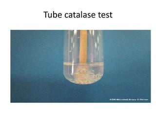 catalase test presented by dr mohan singh dhakad | PPTX