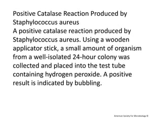 catalase test presented by dr mohan singh dhakad | PPTX