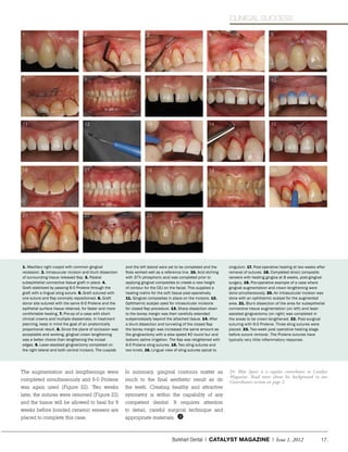 Catalyst.jan .feb .2012.q1