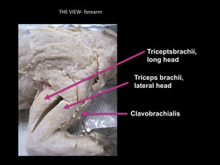 Triceps Brachii Medial Head Cat
