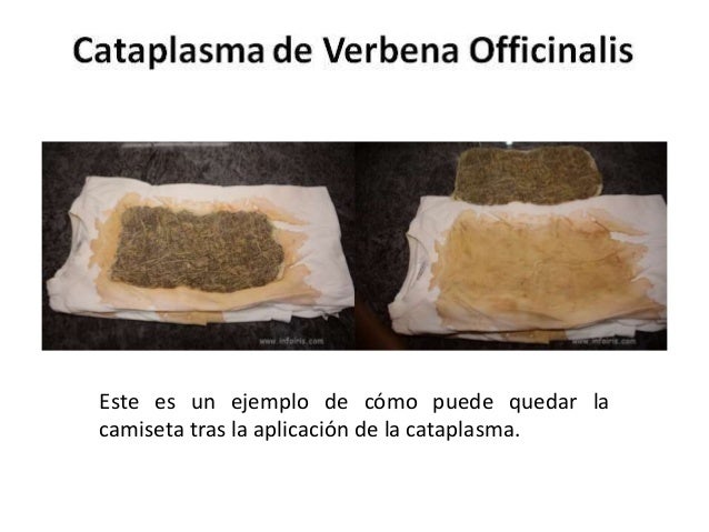 Cataplasma de Verbena Officinalis