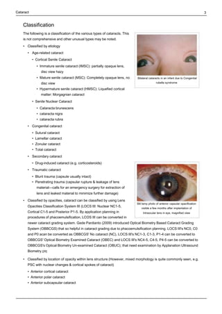 Cataract | PDF