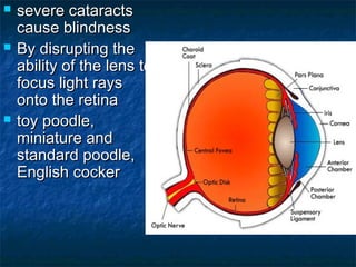 Cataract | PPT