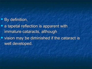 Cataract | PPT