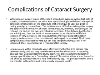 Cataract | PPTX