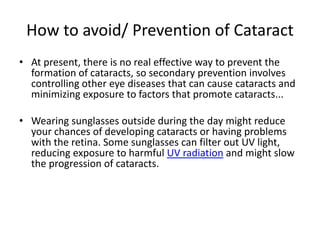 Cataract | PPTX