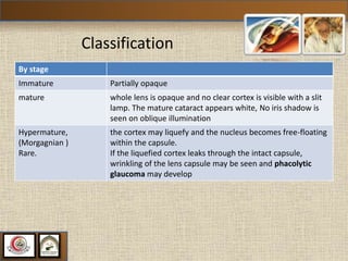 Cataract | PPTX