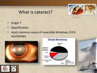 Cataract | PPTX