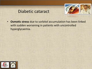 Cataract | PPTX