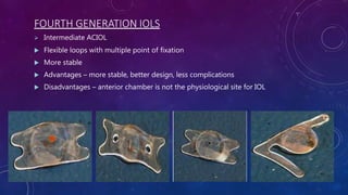 Intraocular lens | PPTX