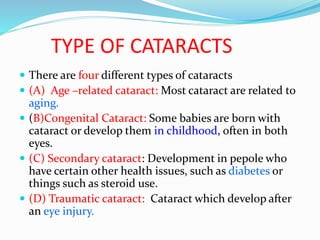 Cataract | PPT