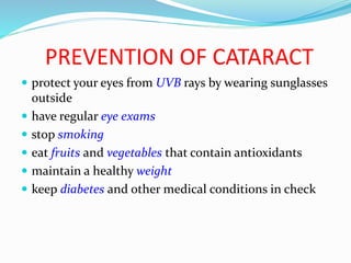 Cataract | PPT