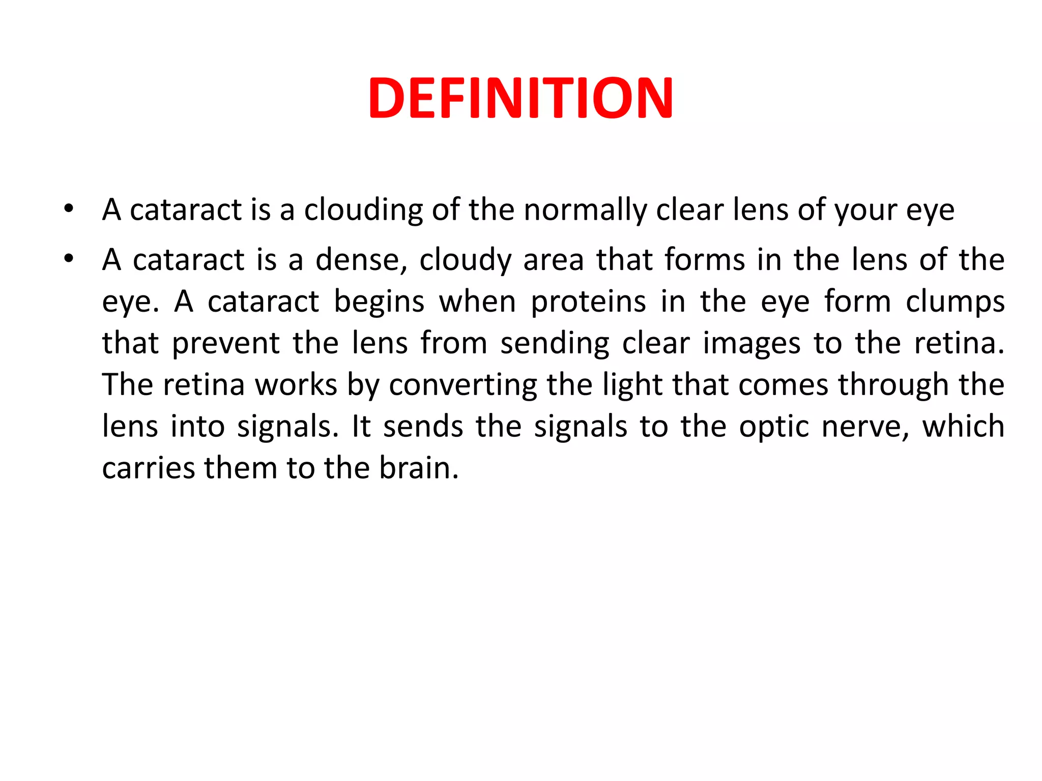 Cataract | PPTX