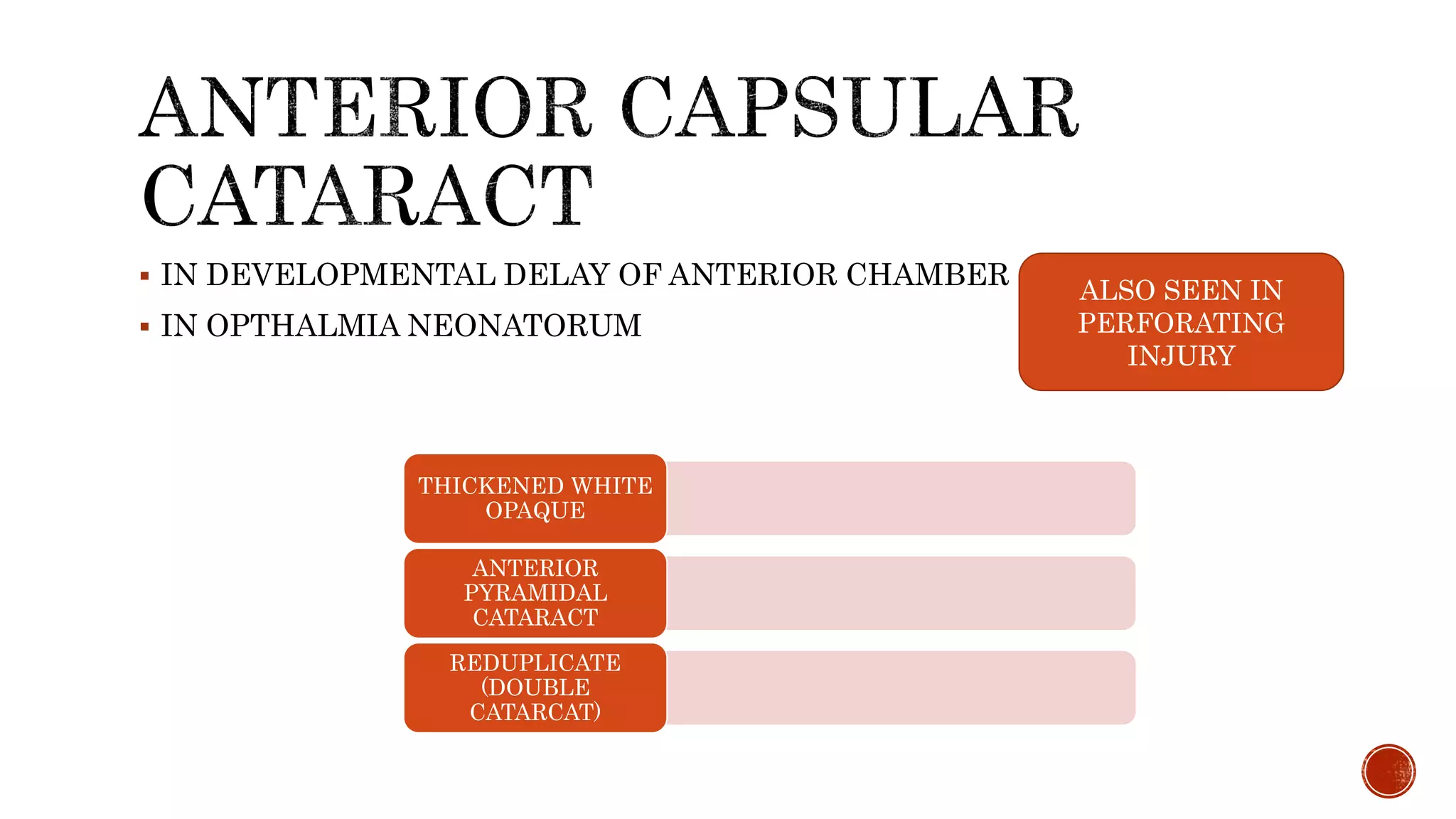 Cataract revisionnotes ophthalmology | PPTX