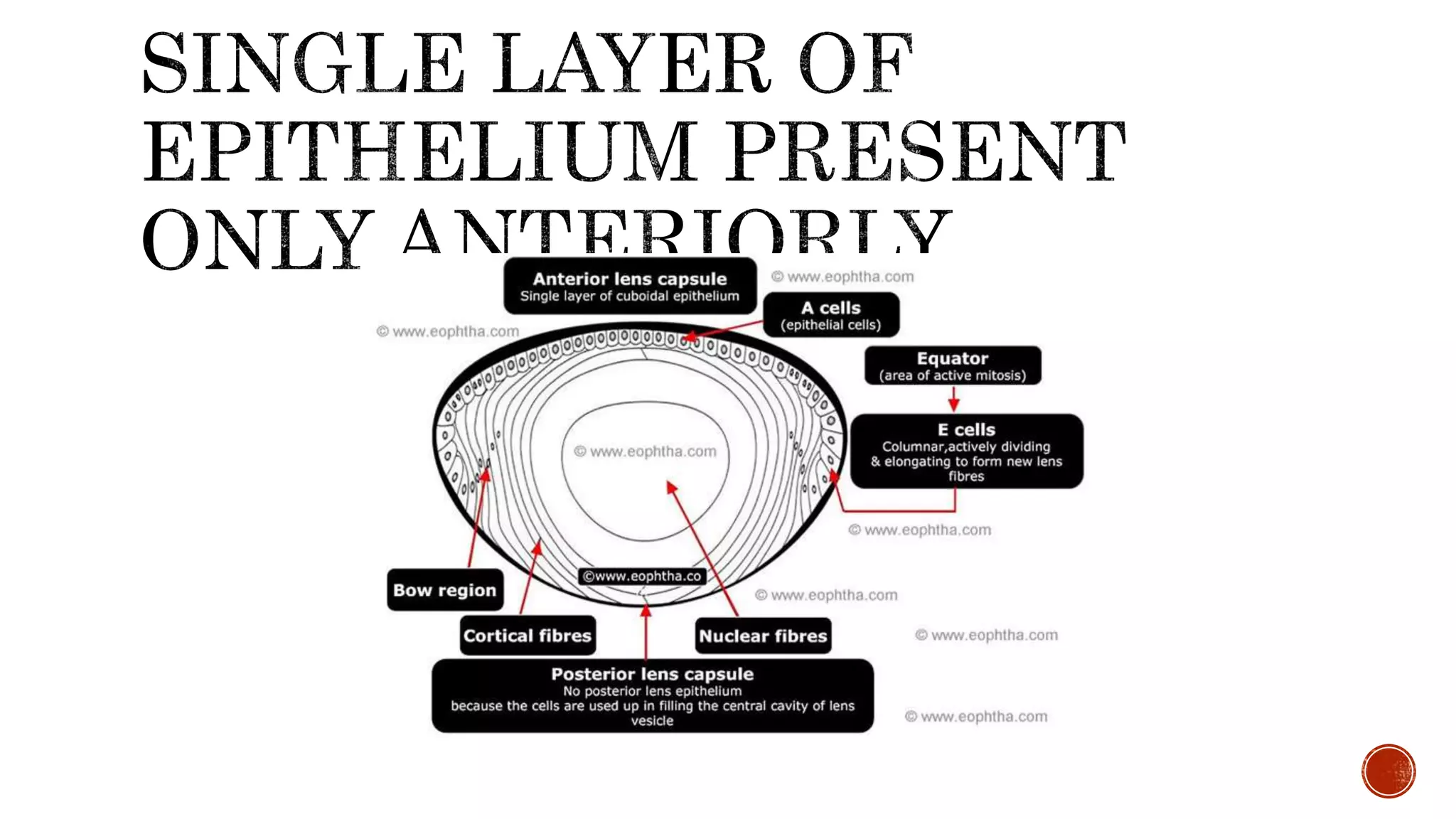 Cataract revisionnotes ophthalmology | PPTX