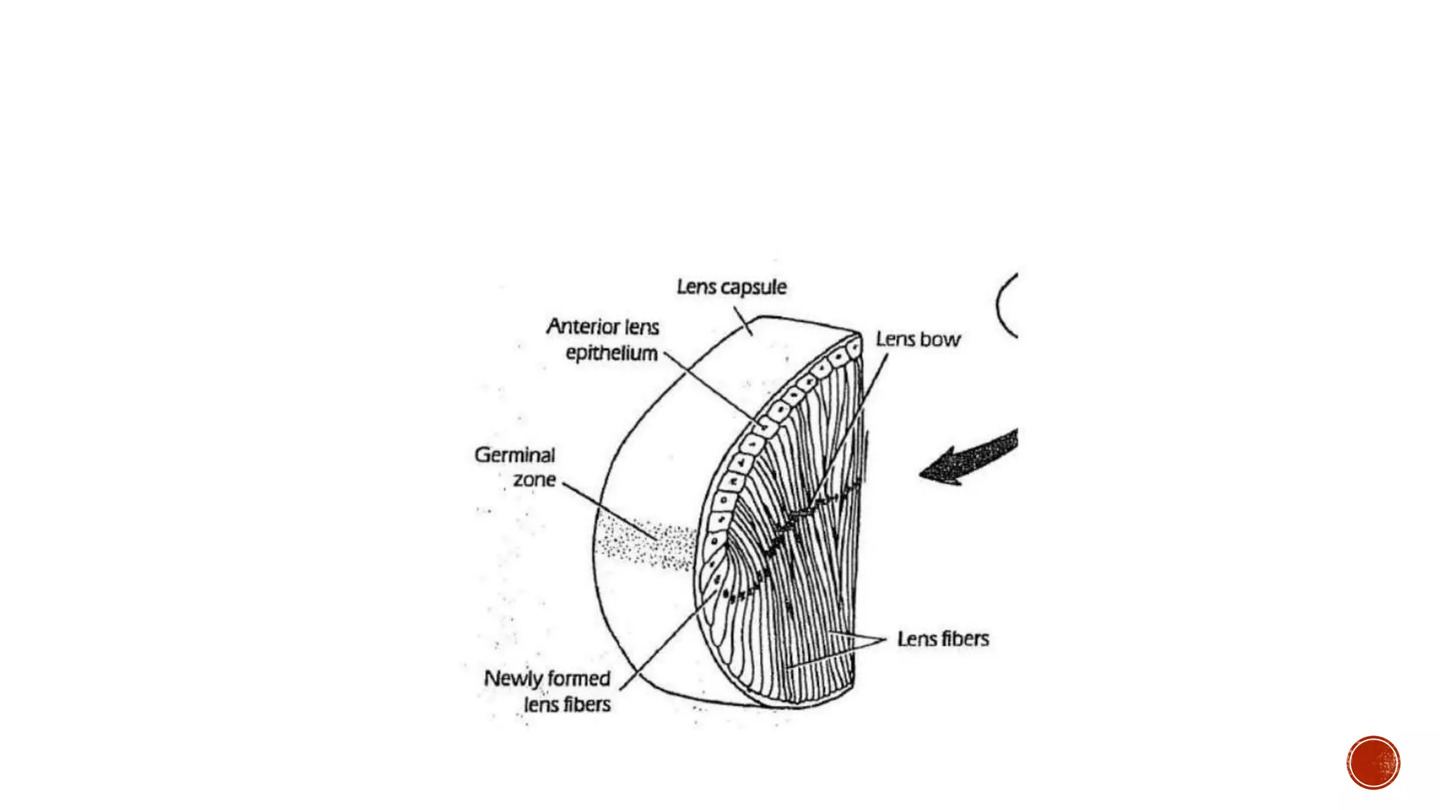Cataract revisionnotes ophthalmology | PPTX