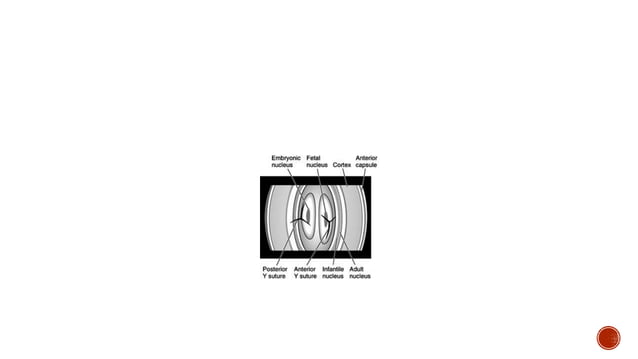 Cataract revisionnotes ophthalmology | PPTX | Eye and Vision Conditions ...