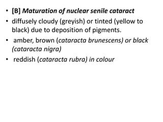 Cataract basic for O.A Students | PPTX
