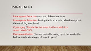 Cataract | PPT