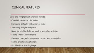 Cataract | PPT