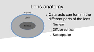 Cataract | PPT
