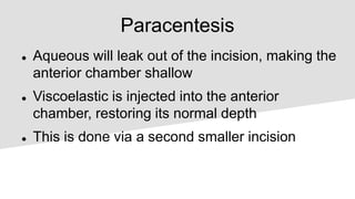 Cataract | PPT