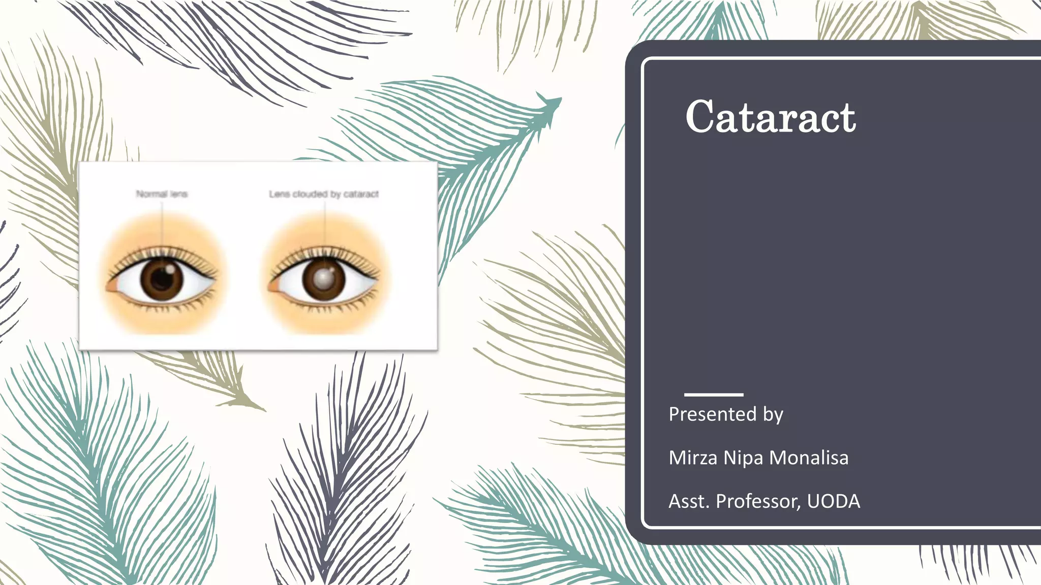 Cataract | PPT
